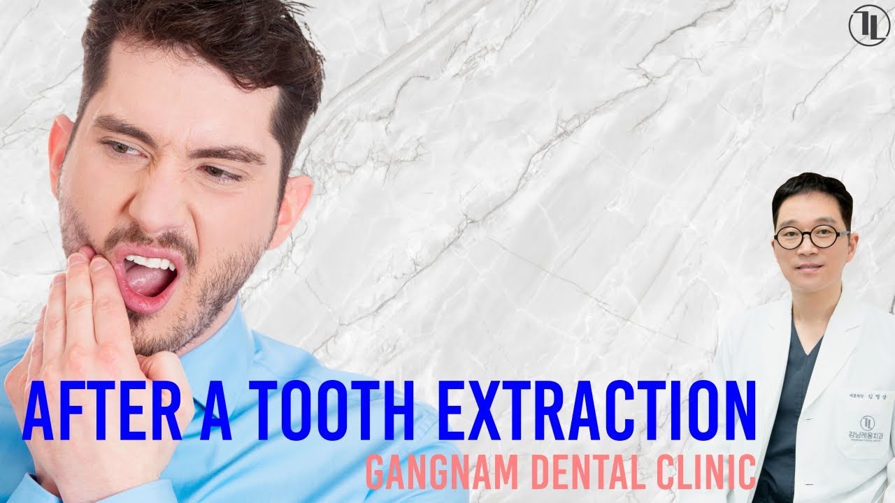"Post-Tooth Extraction Precautions" Essential Tips from Dr. Young-sam ...