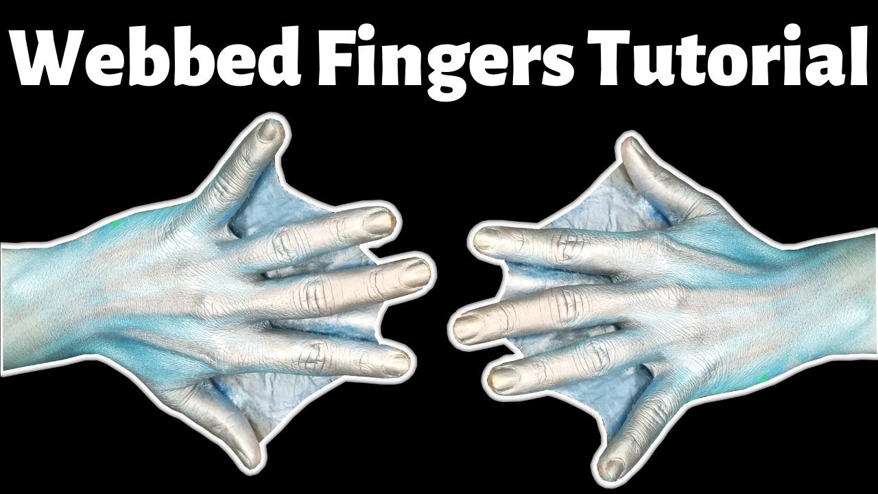 Humans With Webbed Fingers Congenital Defects Of The Hand Brigham City