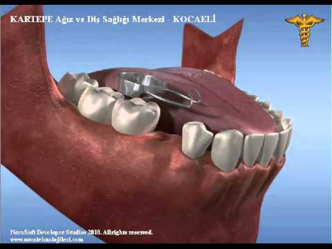 Yer Tutucu - YouTube