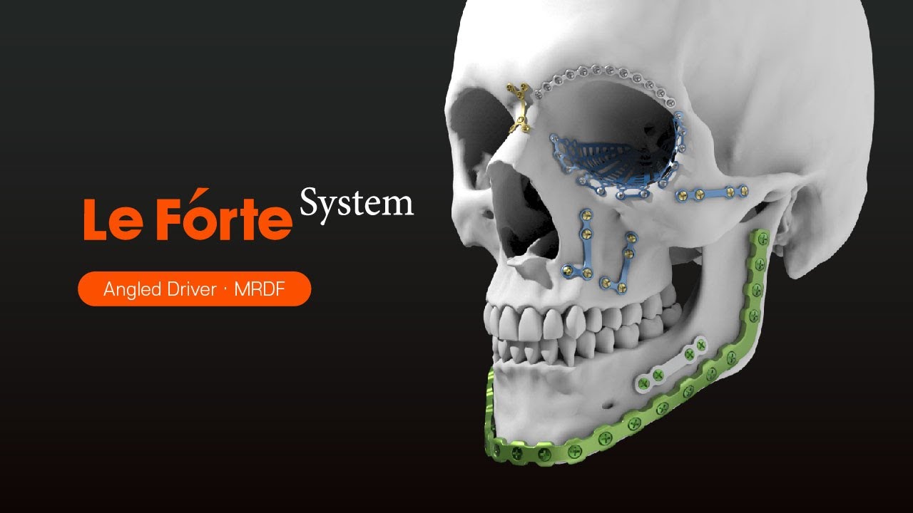 [LEFORTE] LeForte System Product Introduction - YouTube