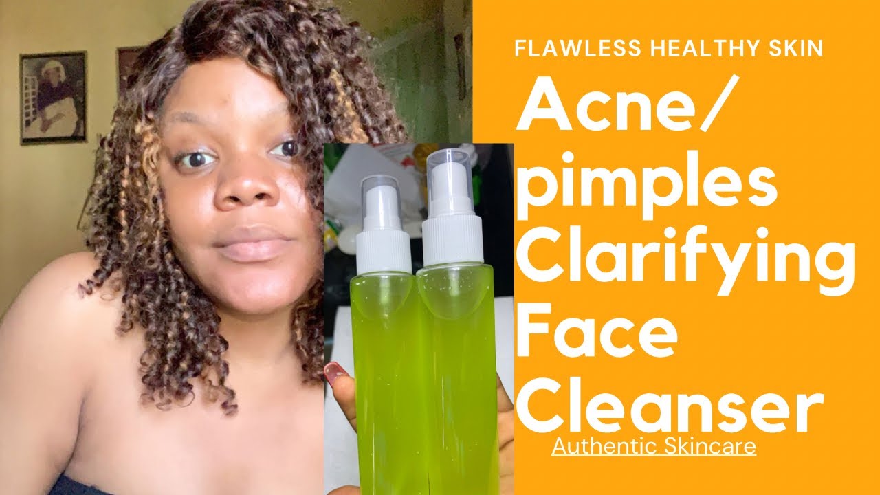 How To Make Acne pimples Clarifying Face Cleanser Toner Clears Pimples How To Make Acne pimples Clarifying Face Cleanser Toner Clears Pimples