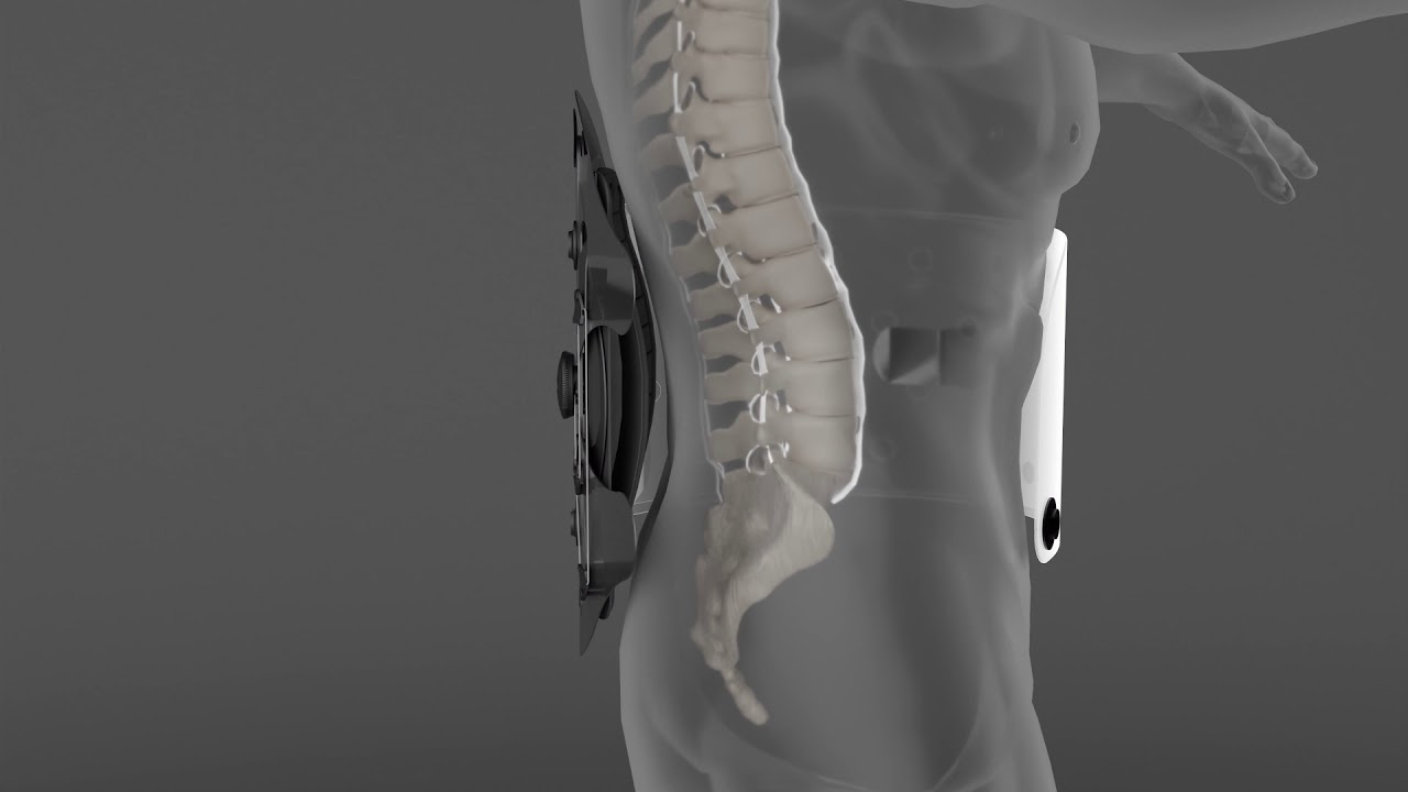 Static Positioning by Lumbrella - YouTube