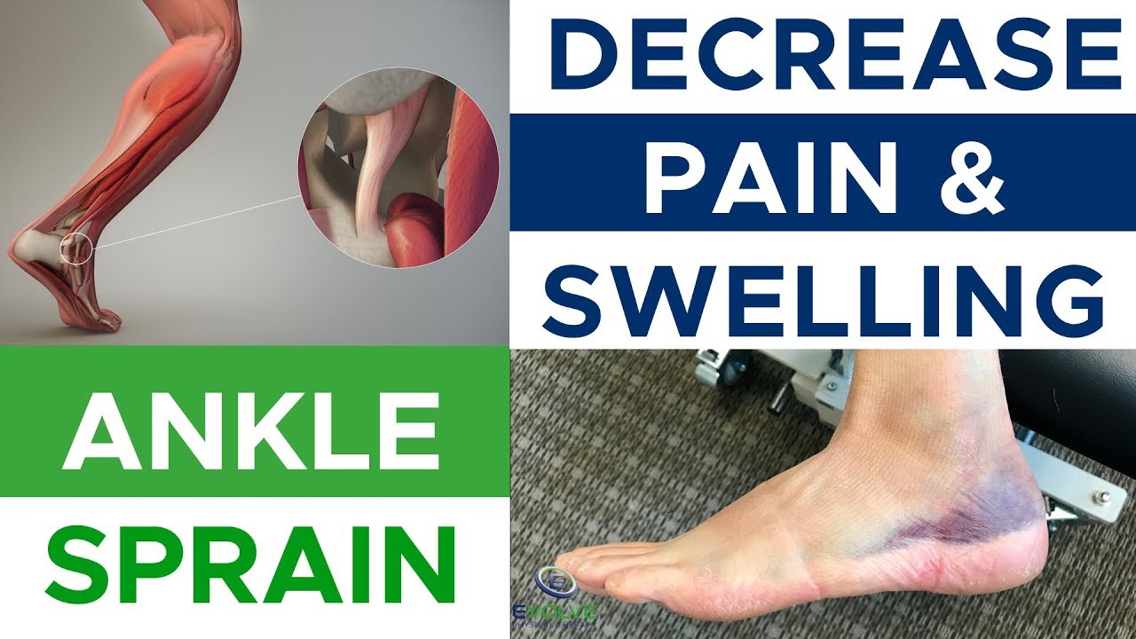 Ankle Sprain | Effectively Decrease Swelling And Pain - YouTube