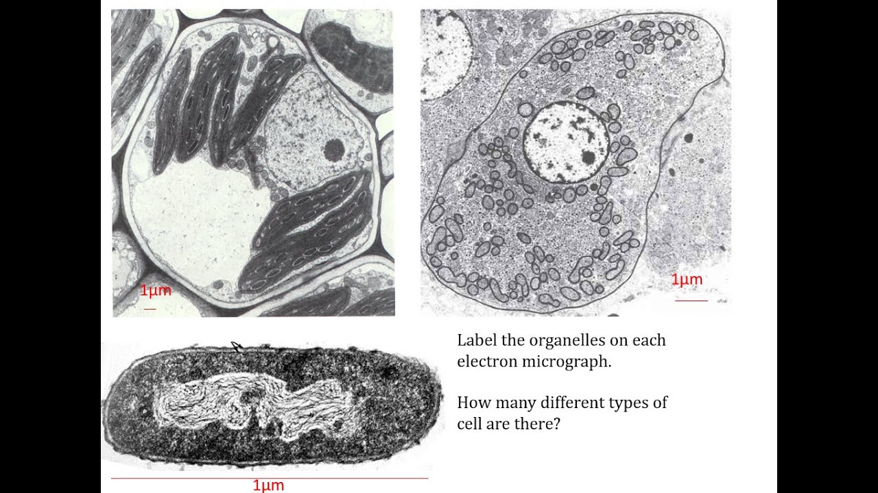 31.3 Identifying Types of Cells and Organelles from Electron ...