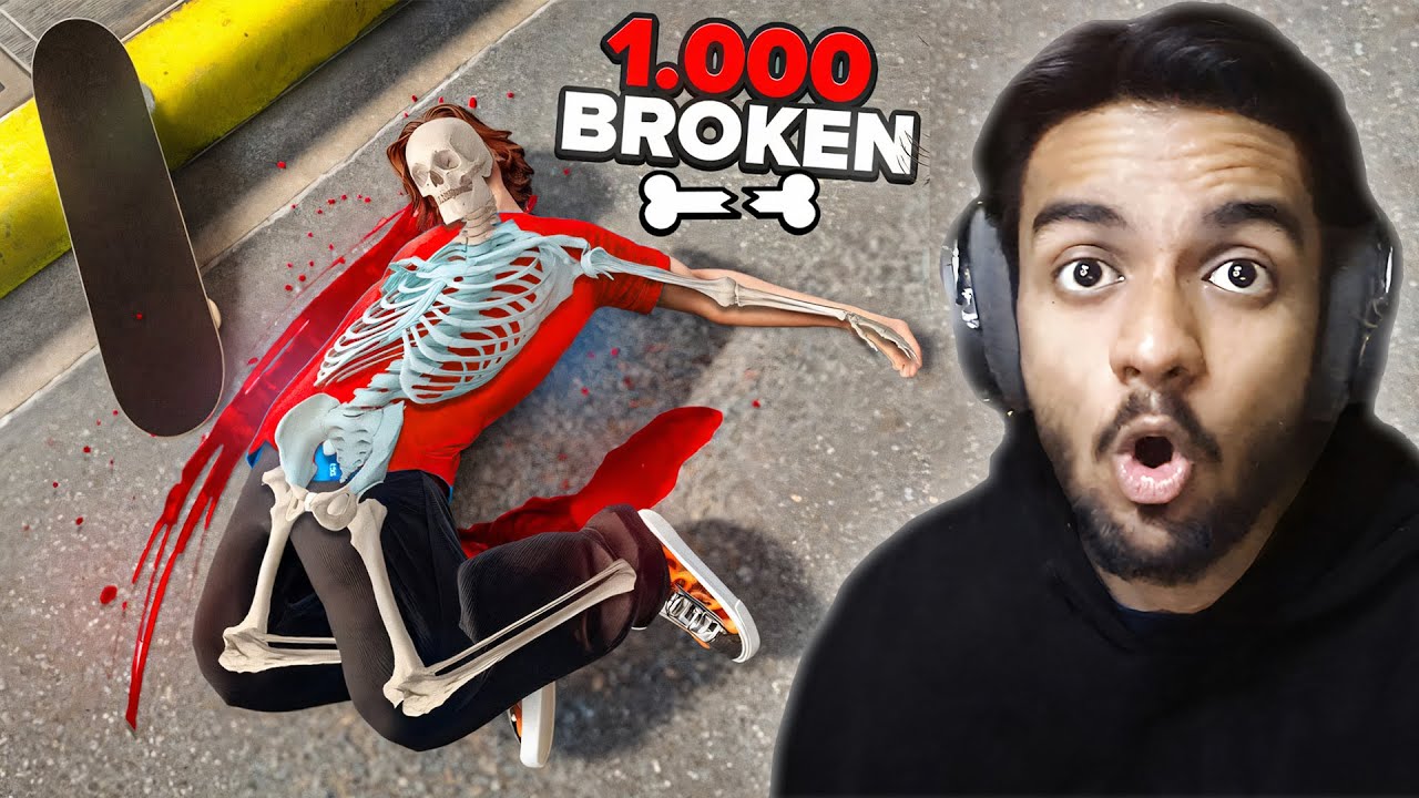 Breaking EVERY Bone in My Body! - YouTube