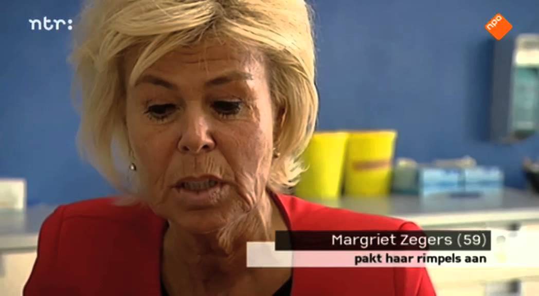 De natuurlijke liquid facelift van Margriet Zegers door Dr. Helga van ...