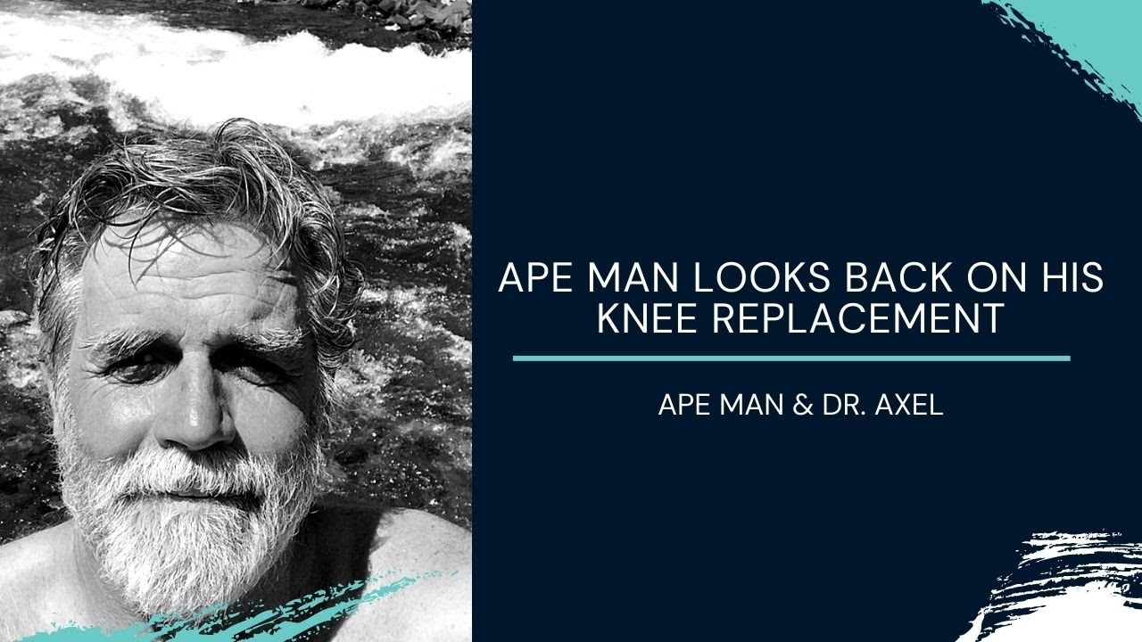 Ape Man looks back on his knee replacement recovery ~2.5 yrs on ...
