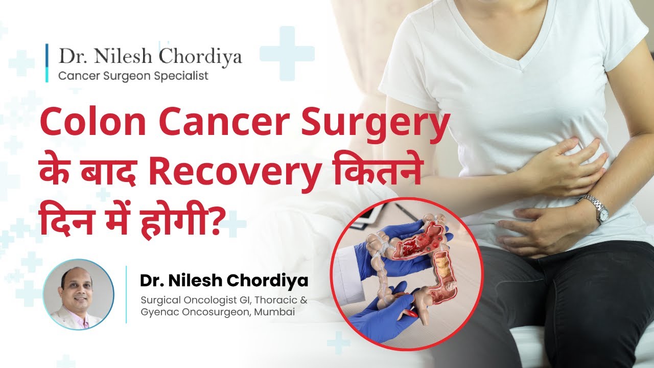 Colon Cancer Surgery के बाद Recovery कितने दिन में होगी? | Dr Nilesh ...