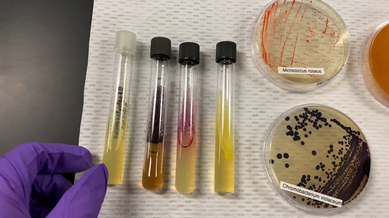 Laboratory: Pigmentation - YouTube