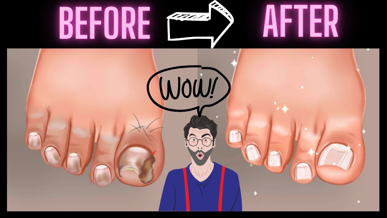 Pedicure/FootCare Routine mustwatch|#asmr#pedicure#pedicureasmr# ...