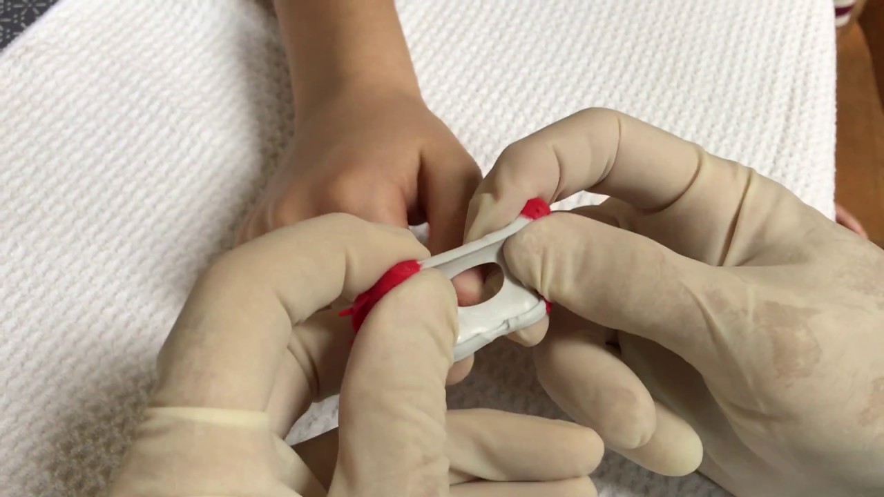 Applying TRING Flex - YouTube