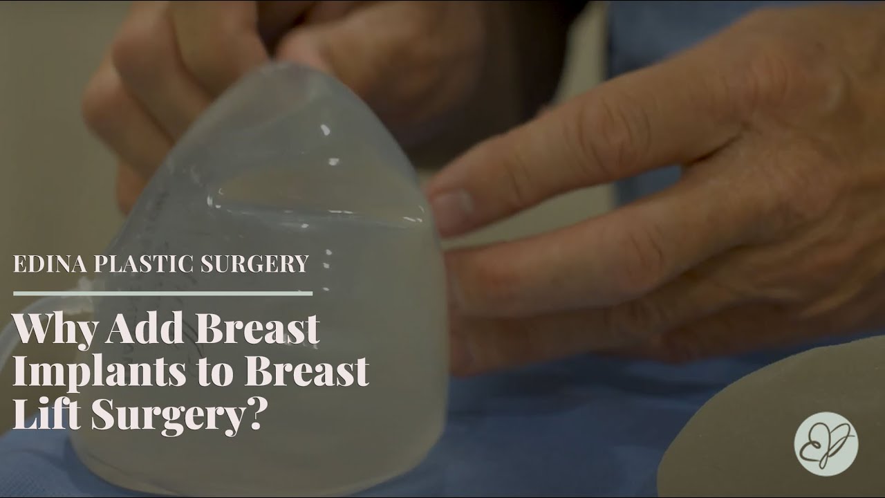 Why Add Breast Implants to Breast Lift Surgery? | Edina Plastic Surgery ...