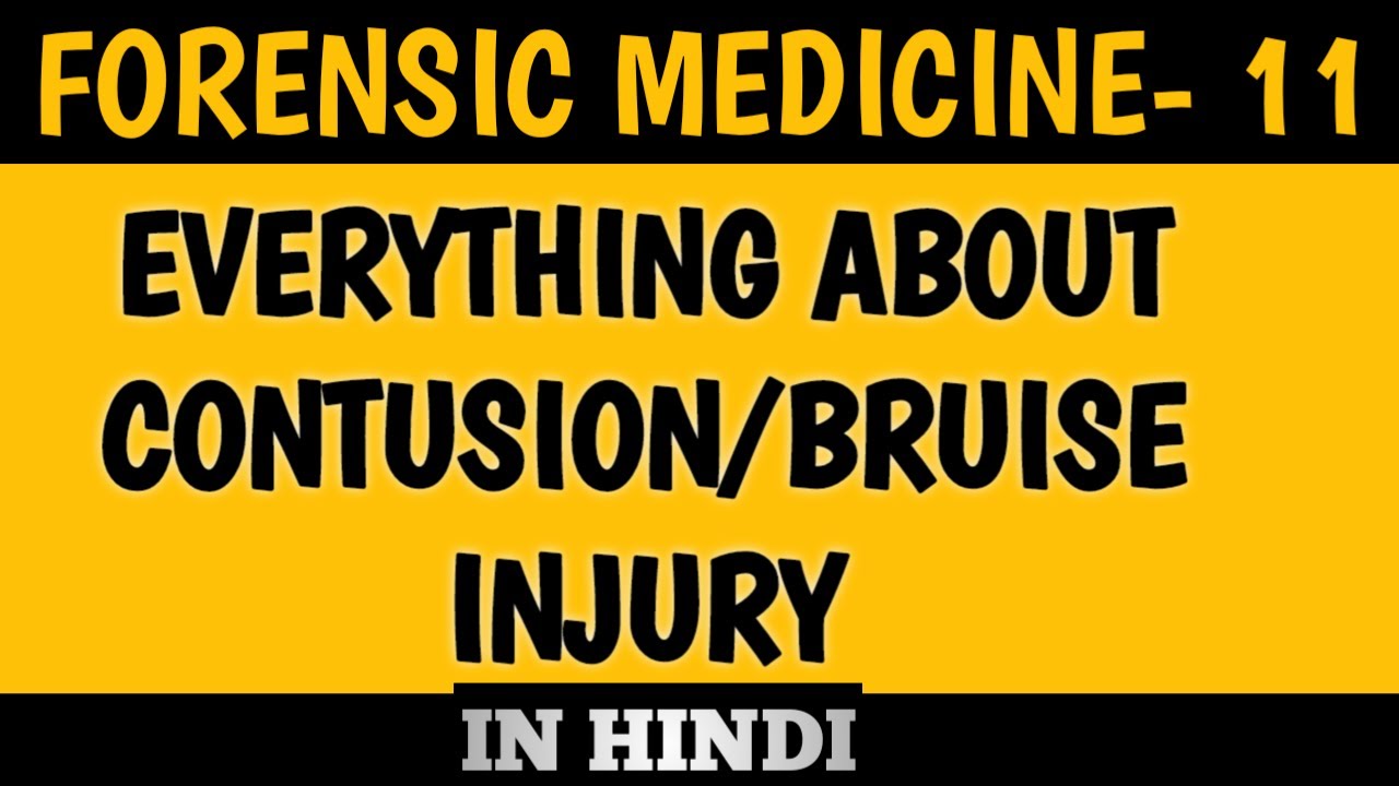 Contusion/Bruise injury in Forensic medicine | FMT chapter 11 part 3 ...