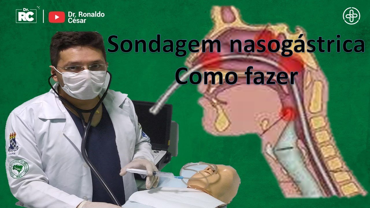 Como passar uma Sonda Nasogástrica: Sondagem Nasogástrica - YouTube