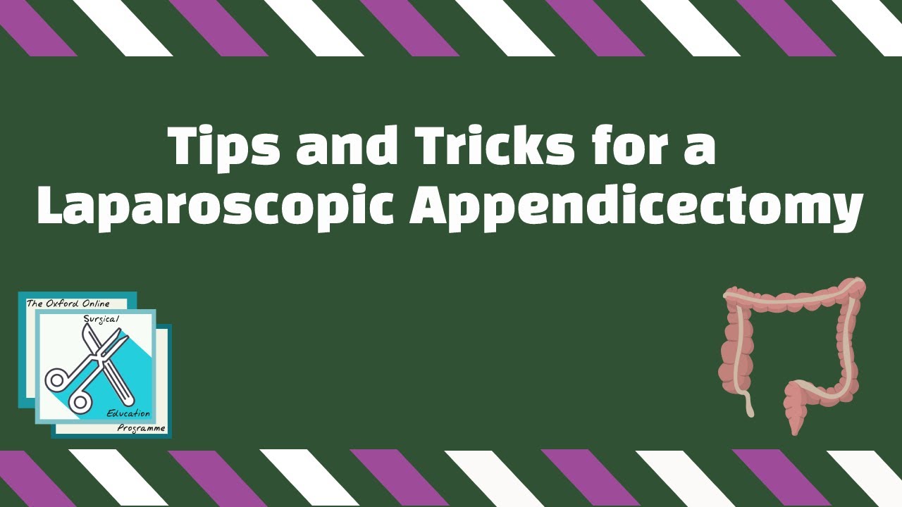 Tips and Tricks for a Laparoscopic Appendicectomy - YouTube