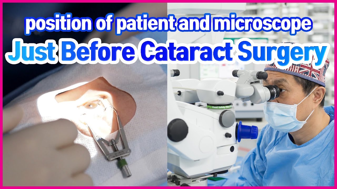 Position of patient and microscope just before cataract surgery - YouTube