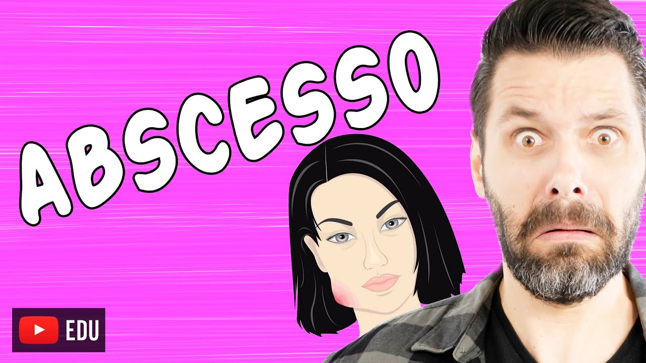 Abscesso O Que é Tipos E Sintomas Biologia Com Samuel Cunha Vidoe