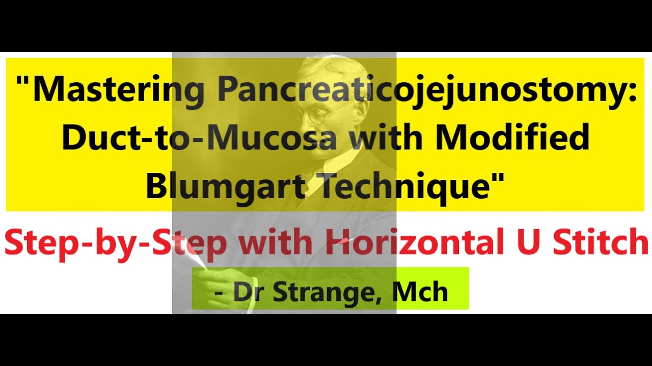 Vid 6.7 (UnCut PJ HD): Master Pancreaticojejunostomy: Modified Blumgart ...
