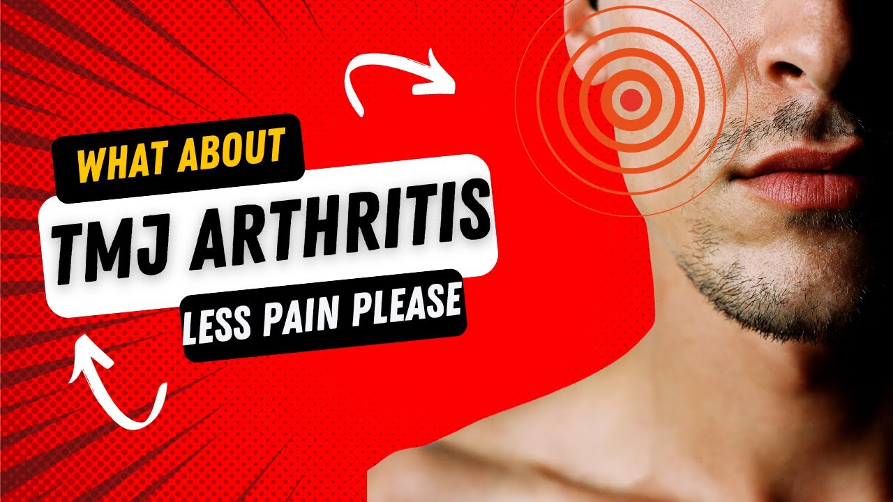 TMJ Arthritis: Causes, Symptoms, and Treatment Options - YouTube