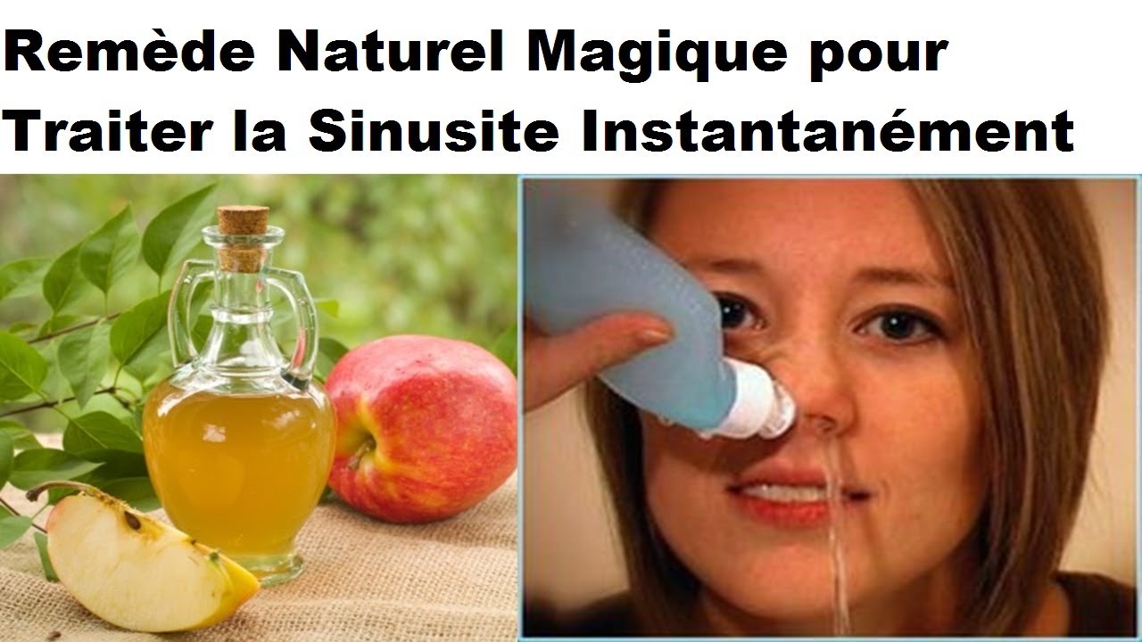 sinusite traitement naturel #remedesnaturels - YouTube