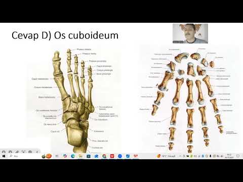 Tıbbi Terminoloji ve Osteoloji 10 adet Örnek Soru Çözümü Anatomi, İnsan Anatomisi, TUS, DUS, Tıp,SBF