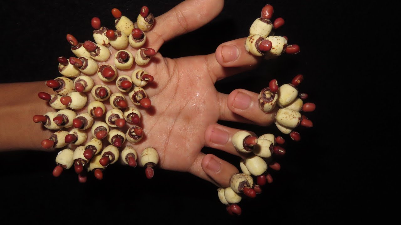 Wow, Amazing removing so big ticks style on hand boy | Designed from ...