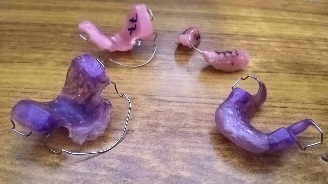 Understanding Parts of Removable Appliances in Orthodontics - YouTube