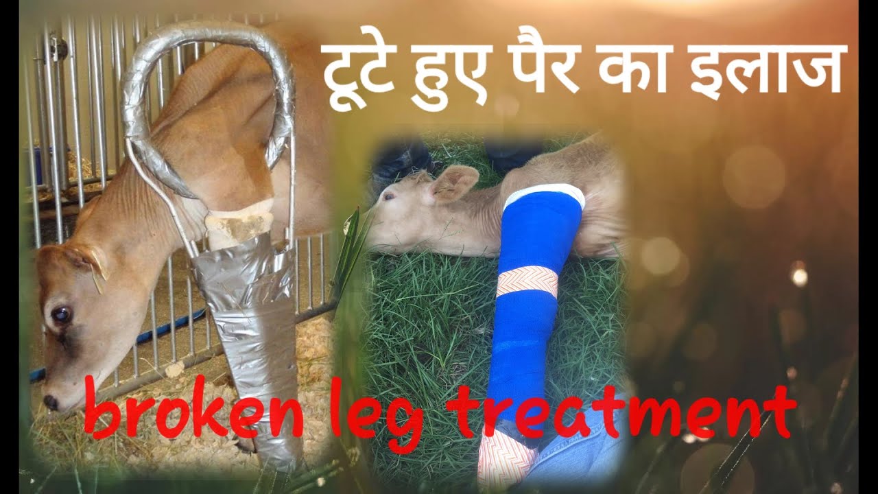 broken leg treatmen | leg fracture | complete tutorial #brokenleg # ...