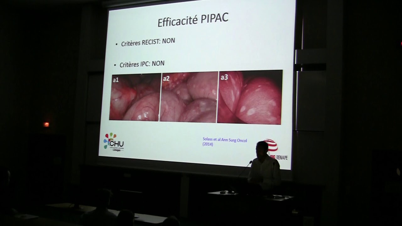 PIPAC (Pressurized Intra-Peritoneal Aerosol Chemotherapy) et carcinose ...