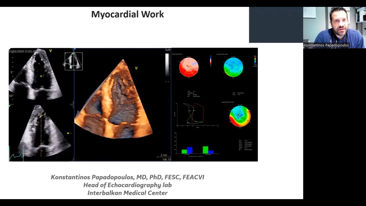 Left Ventricle Myocardial Work - YouTube