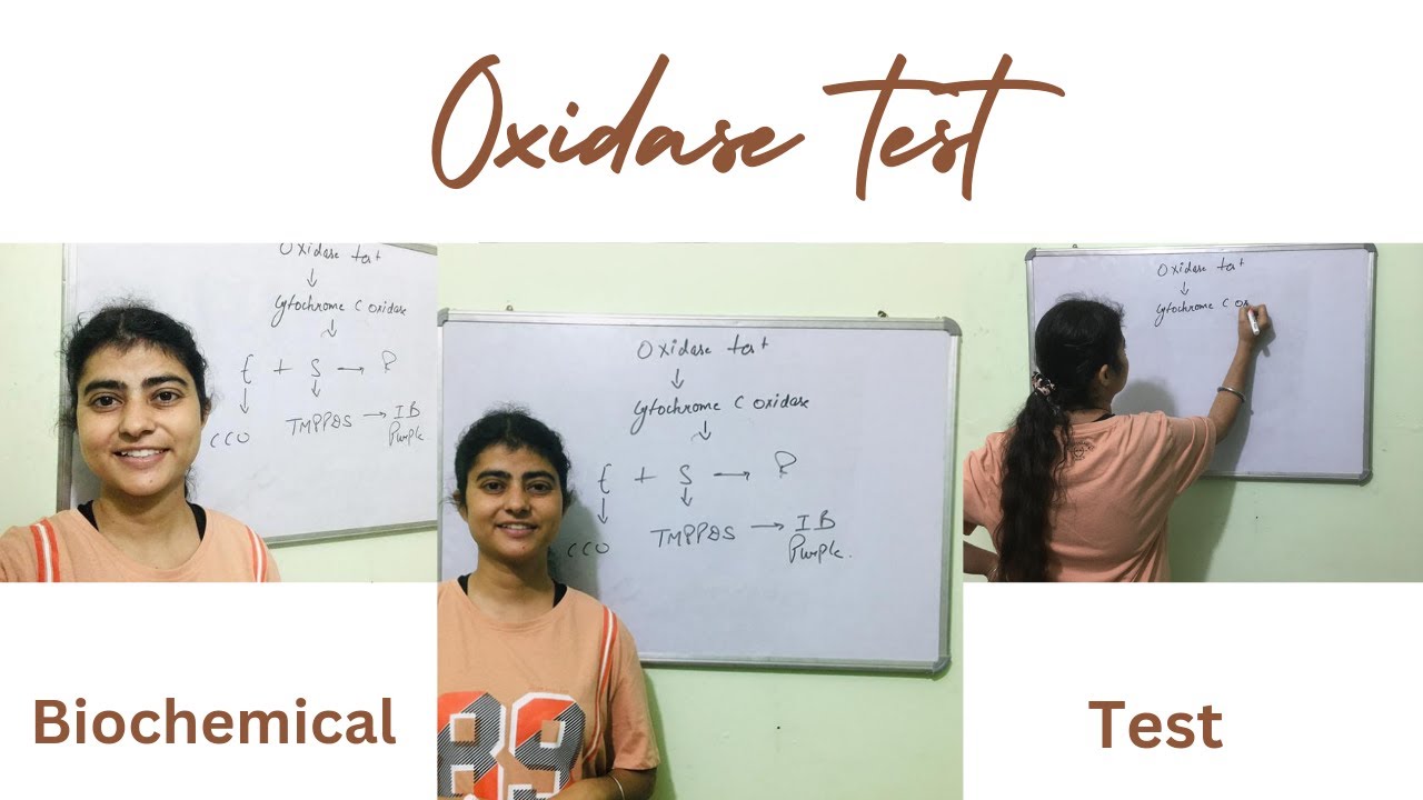 Oxidase test || Indophenol oxidase test|| biochemical test in ...