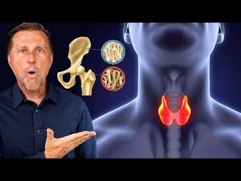 Tiroid Hormonu Tedavisi: Beklenmedik Riskler ve Uzun Vadeli Etkiler | Dr. Berg Türkçe