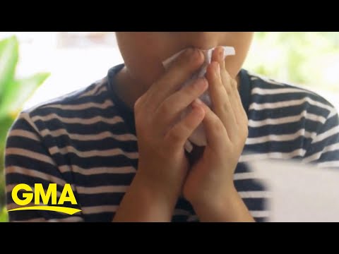 What is bronchitis and when does it require hospitalization?