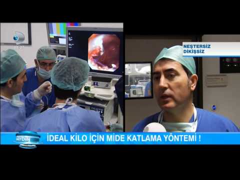 Kanal D İrfan Değirmenci ile Sabah Haberleri Apollo ameliyatsız, endoskopik mide küçültme