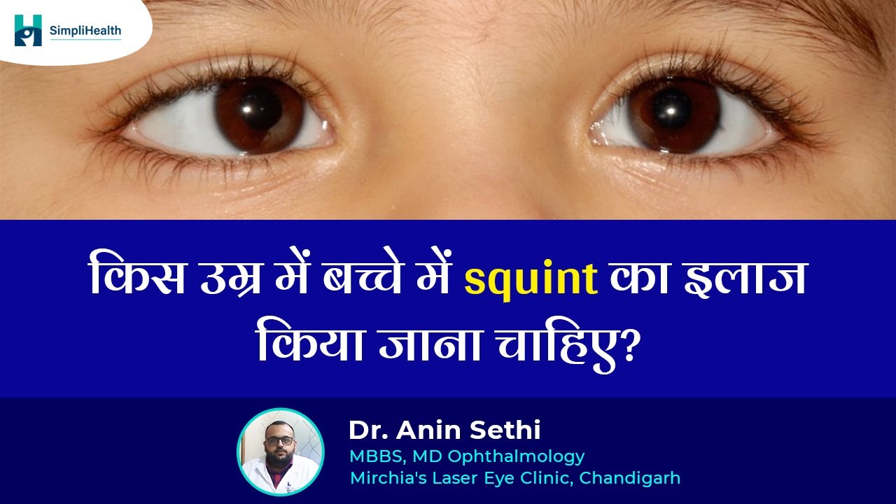 Squint Surgery in Hindi | Squint Surgery Ke Liye Age Limit - Dr. Anin ...