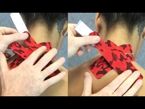 KT tape neck pain. KT taping or kinesiology taping - YouTube