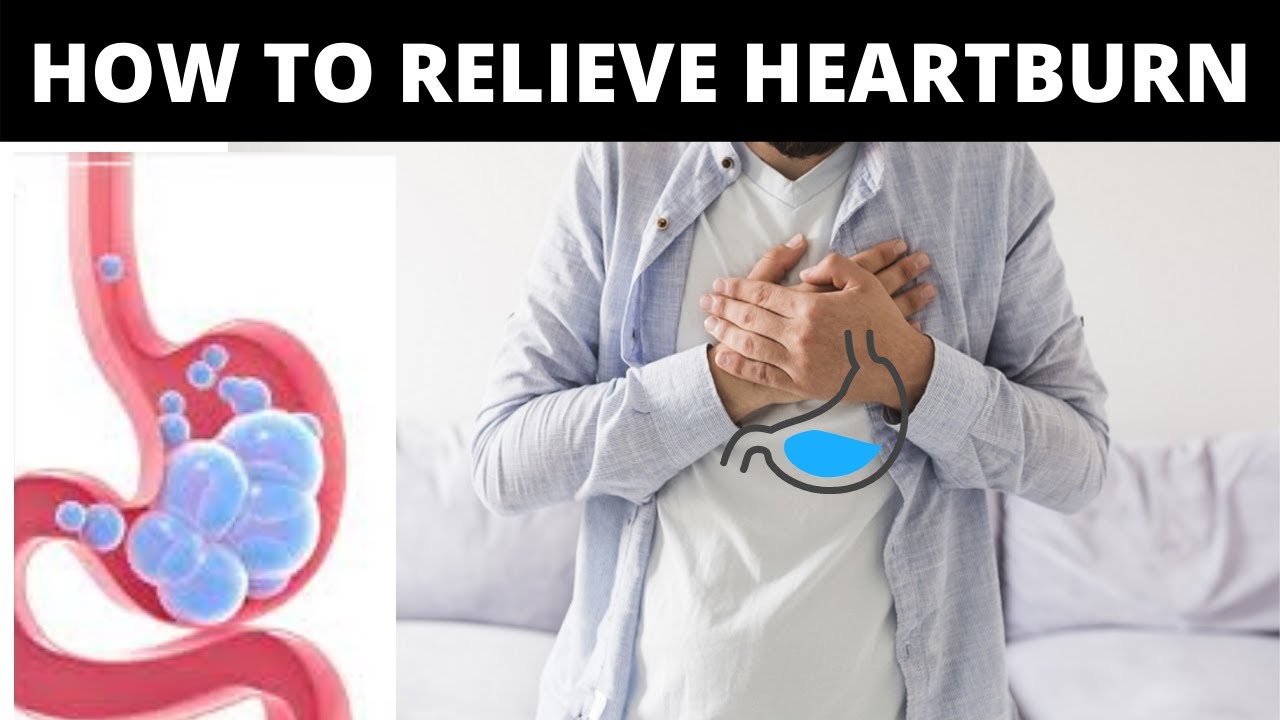 HEARTBURN SYMPTOMS AND CAUSES || HOW TO RELIEVE HEARTBURN || (GERD ...