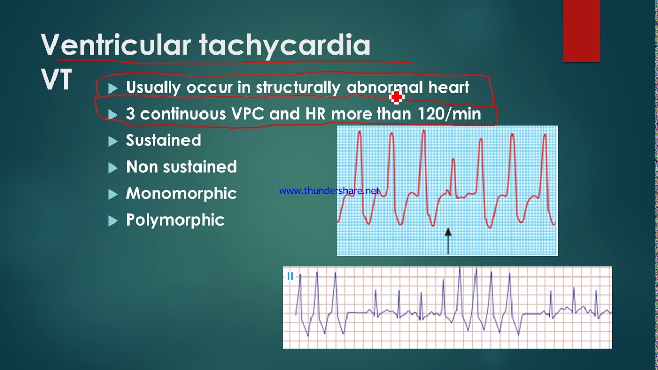 4 1 internal medicine by dr said rahat haidary lecture 17 - YouTube