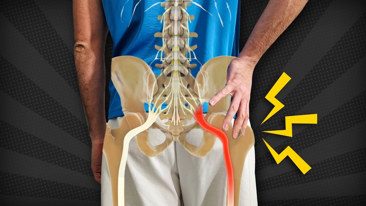 12 EJERCICIOS para desbloquear el NERVIO CIATICO - YouTube