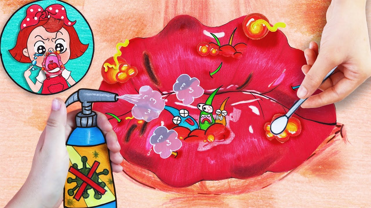 Seegi Gets Stung By Caterpillar! How To Treat Cold Sores || 애벌레에 쏘인 ...