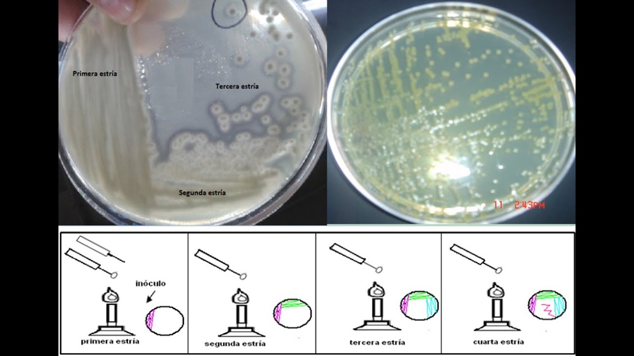 Estría cruzada - YouTube