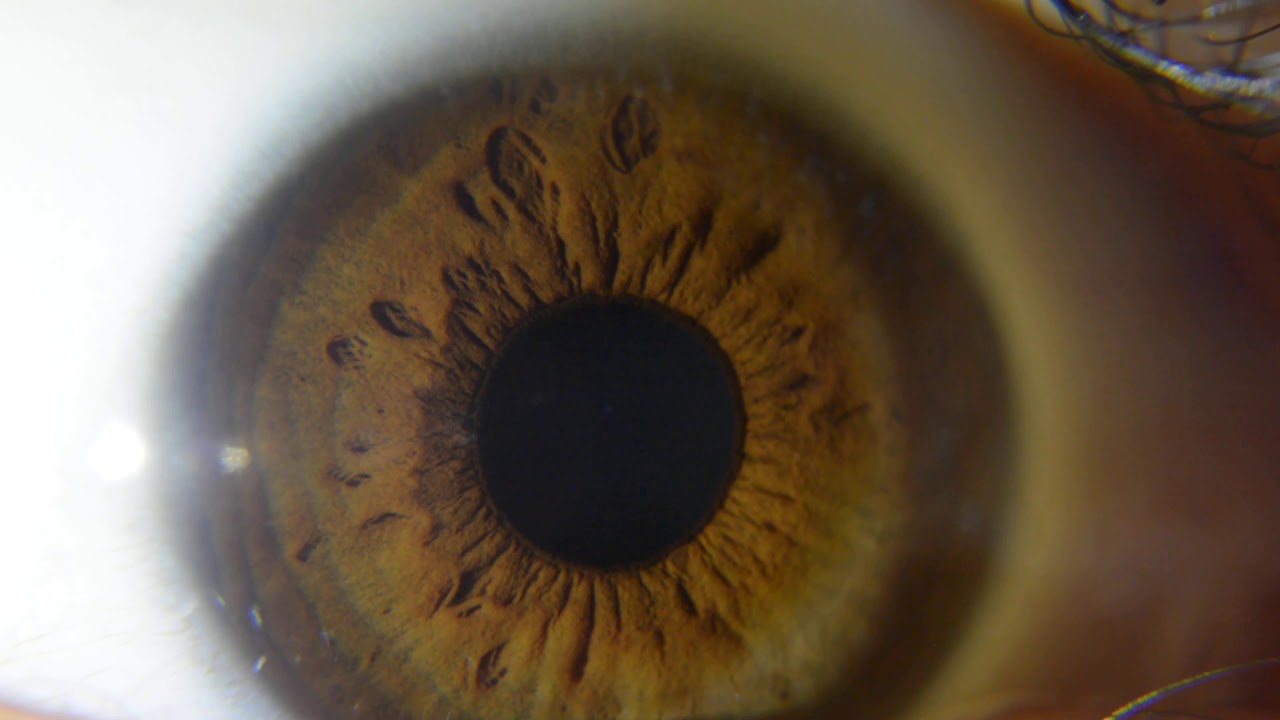 Macro view of an eye - YouTube