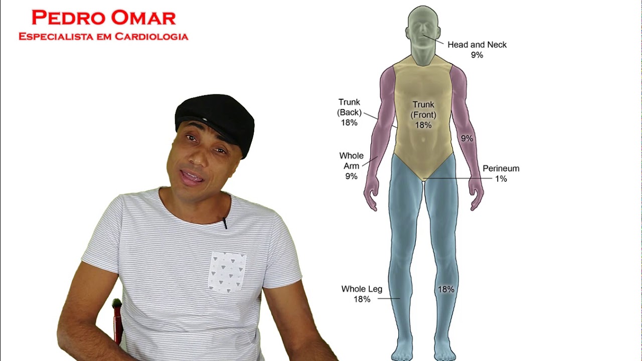 Rompe Bolha nas Queimaduras? Regra dos 9 - Superfície Corpórea Queimada ...