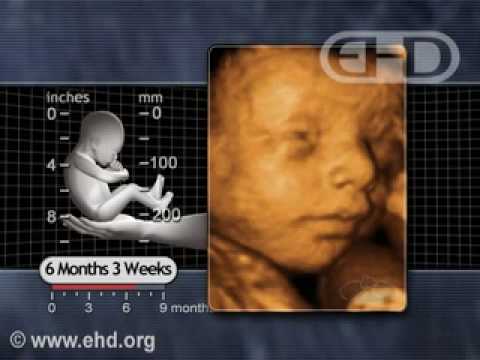 Smiling 27-Week Fetus -- Eyes produce tears - YouTube