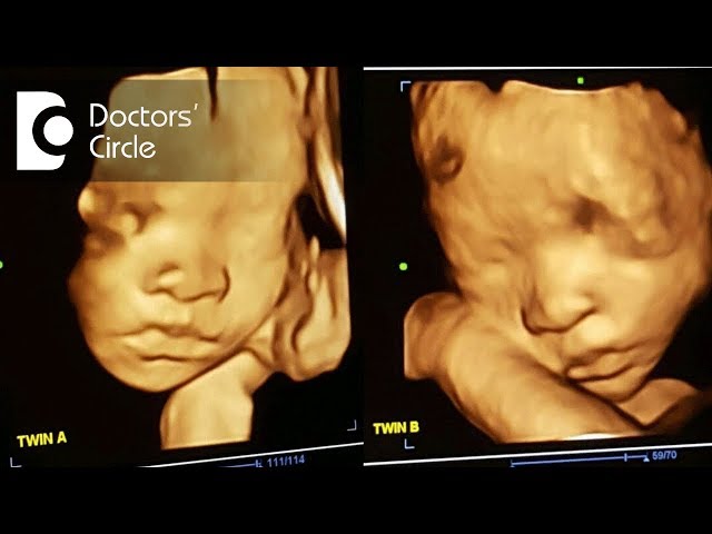 Identical Twins 3d Ultrasound I Knew Something Was Wrong': Couple