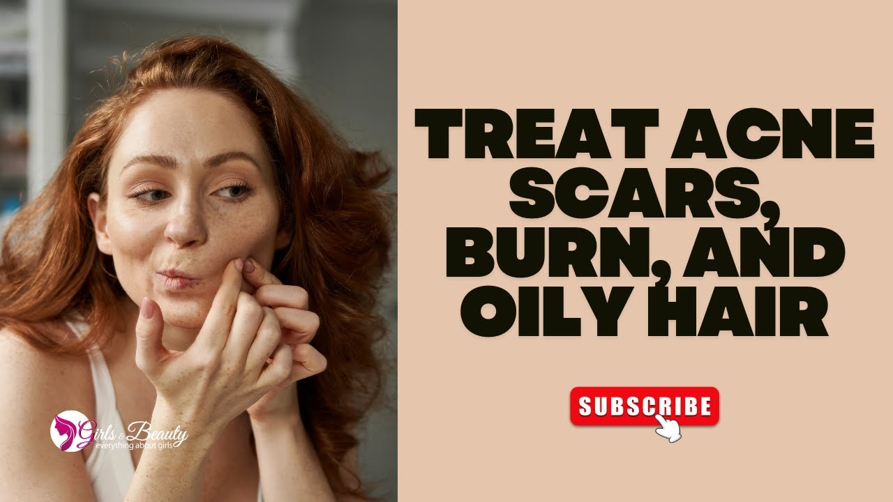 Say Goodbye to Acne Scars, Razor Burn, and Oily Hair with These Game ...
