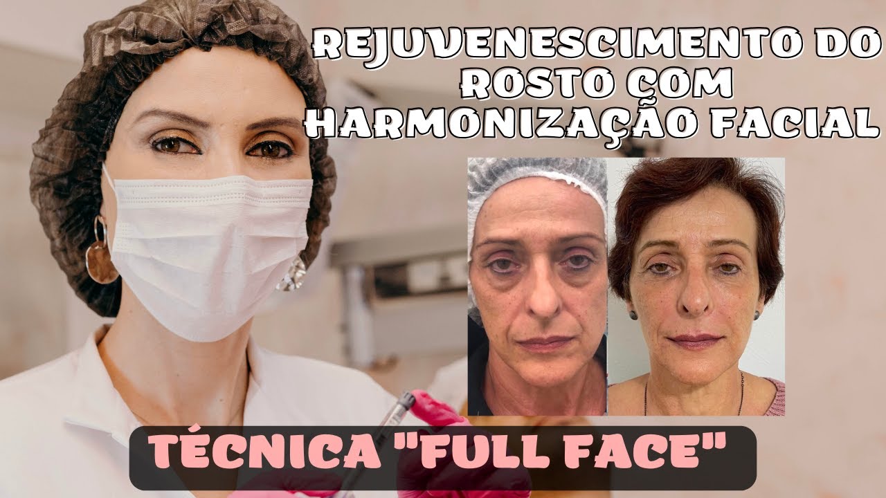 REJUVENESCIMENTO FACIAL COM HARMONIZAÇÃO FULL FACE - YouTube
