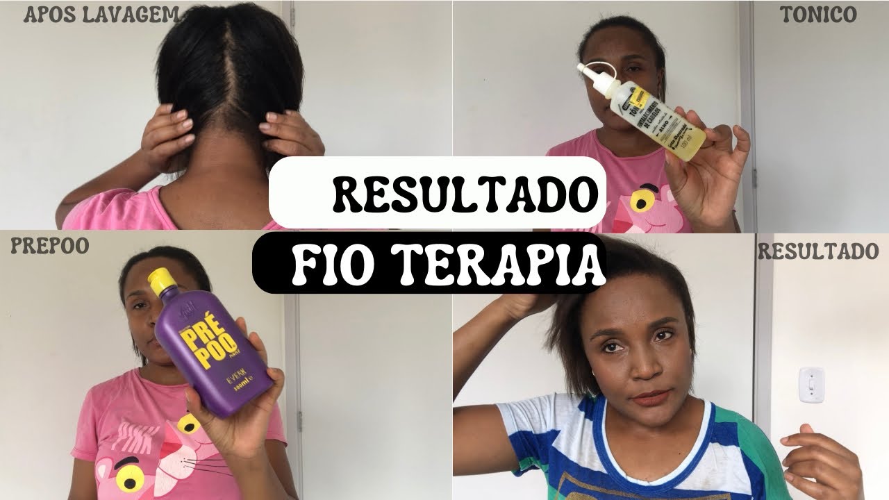 Resultado da Fio Terapia / Primeiro Tratamento - YouTube