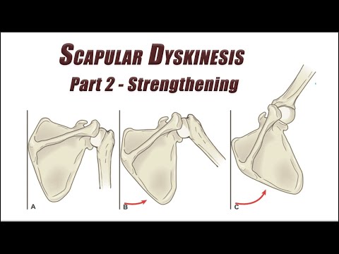 Fix Your Scapular Dyskinesis Part 2 | Strengthening Exercises - YouTube
