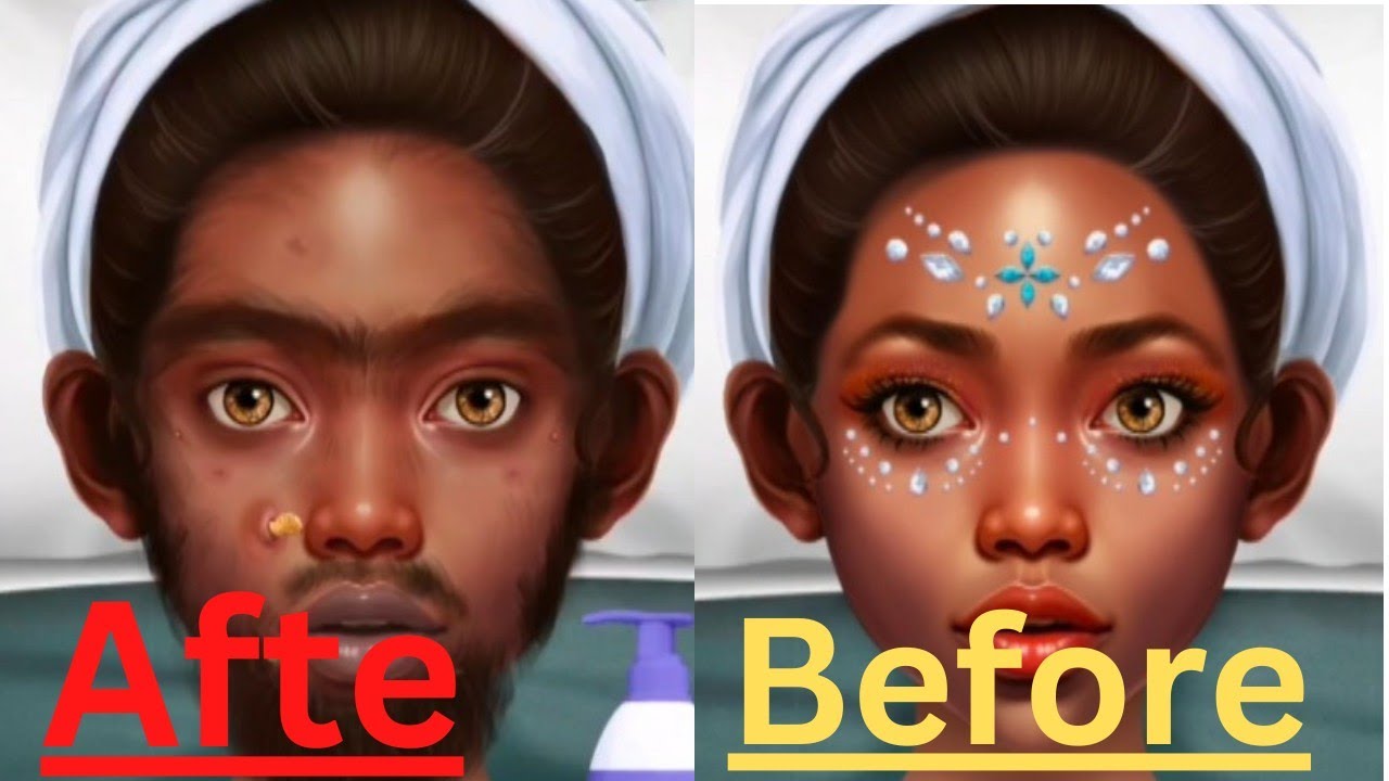 ASMR how to treatment large sebum, restore damaged facial skin very ...